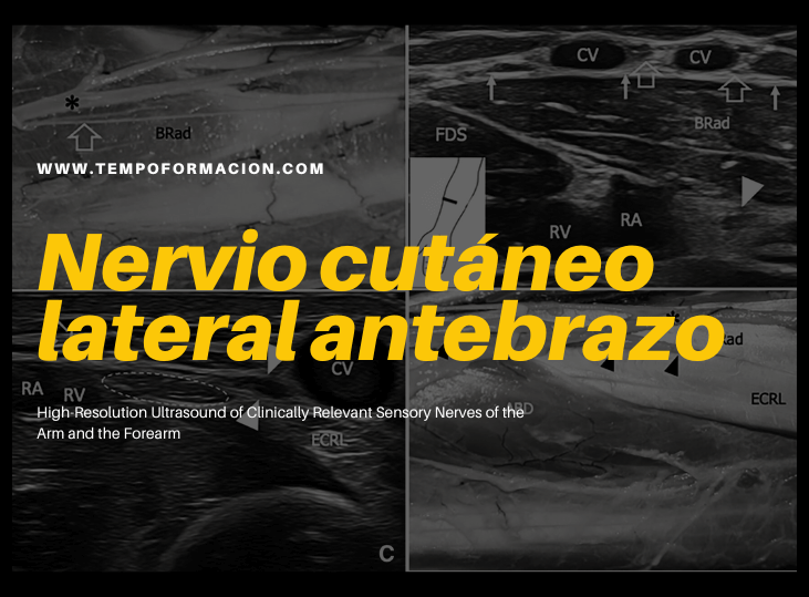 Nervio cutáneo lateral antebrazo y ecografía | Tempo Formación