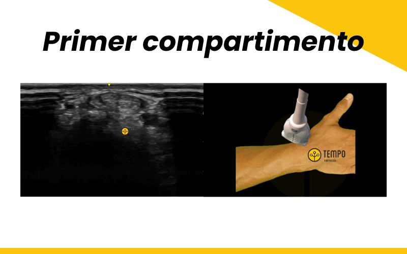 Compartimentos de la muñeca y Ecografía | Tempo Formación