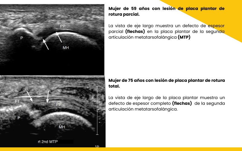 Preguntas y respuestas ecografía 12 | Tempo Formación
