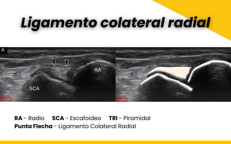 Preguntas y respuestas ecografía 12 | Tempo Formación