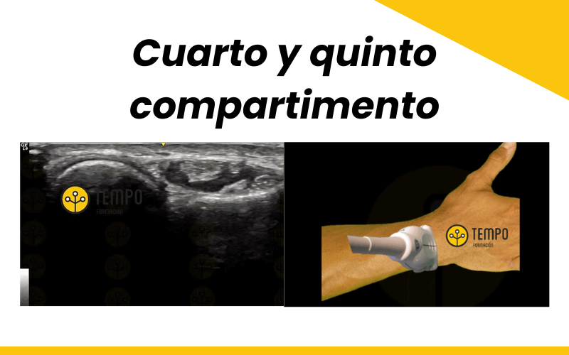 Compartimentos de la muñeca y Ecografía | Tempo Formación