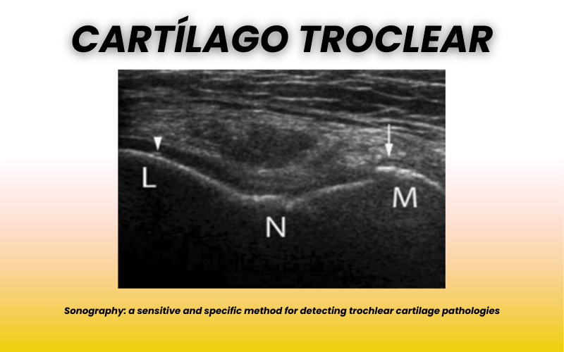 Ecografía y patología de la rodilla | Tempo Formación