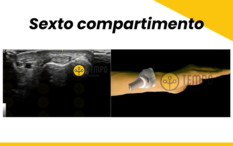 Compartimentos de la muñeca y Ecografía | Tempo Formación