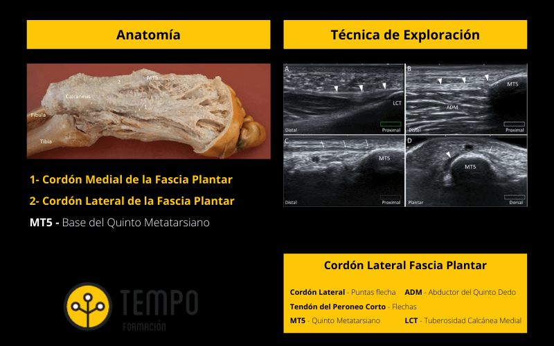 Ecografía avanzada de Tobillo y Pie | Tempo Formación