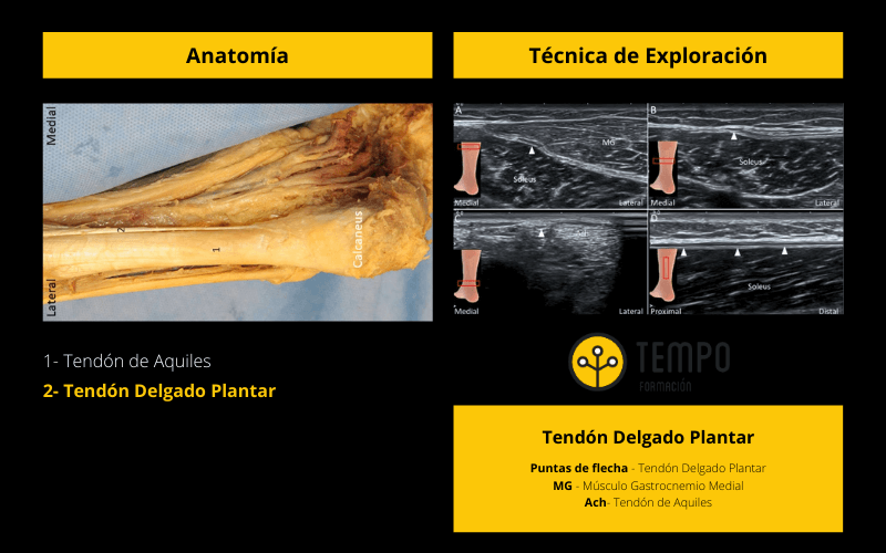 Ecografía avanzada de Tobillo y Pie | Tempo Formación