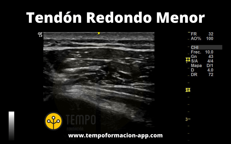 Manguito Rotador y Ecografía | Tempo Formación
